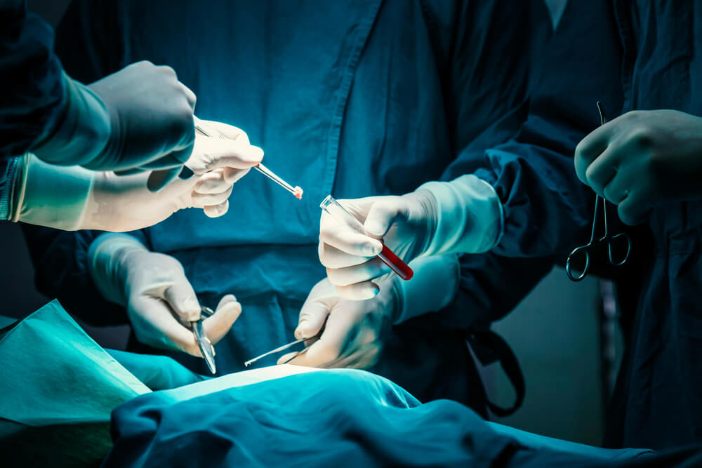 Biopsie: Ce trebuie sa stii | MedLife