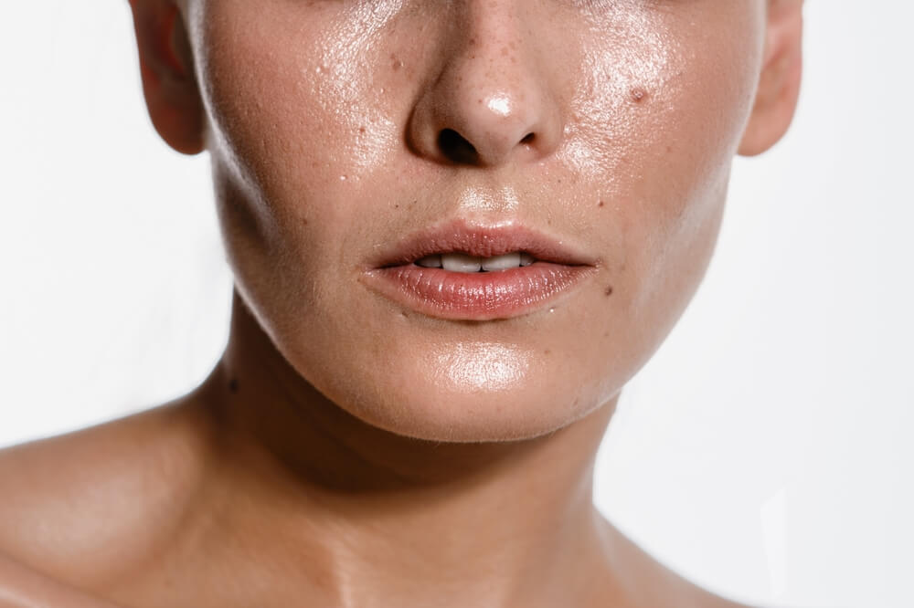 Ten gras: cauze, sfaturi si recomandari | MedLife