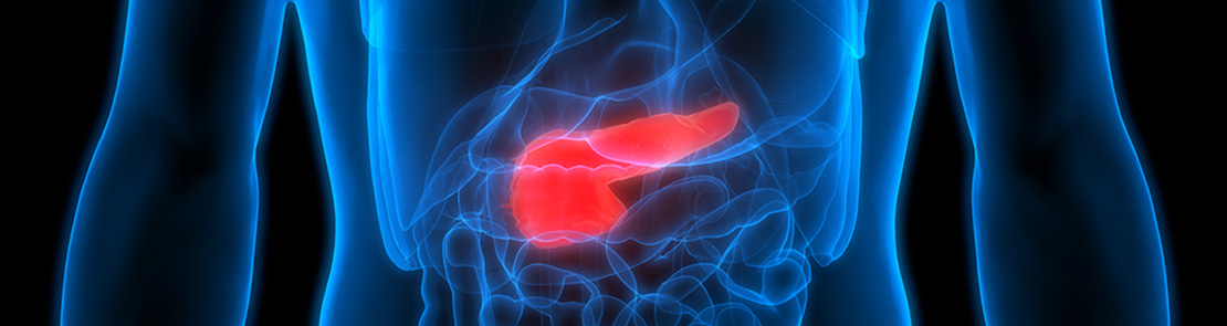 Pancreatită: Cauze, simptome, tratament | MedLife