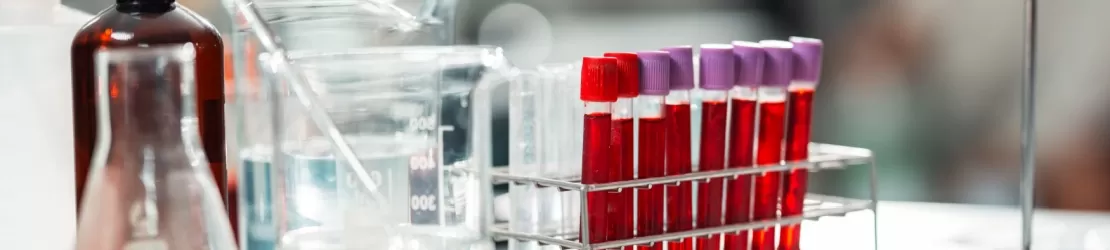 RDW crescut: ce inseamna, cauze, implicatii pentru santate | MedLife
