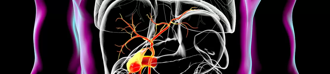 Colecistectomie: in ce consta, cand e recomandata | MedLife