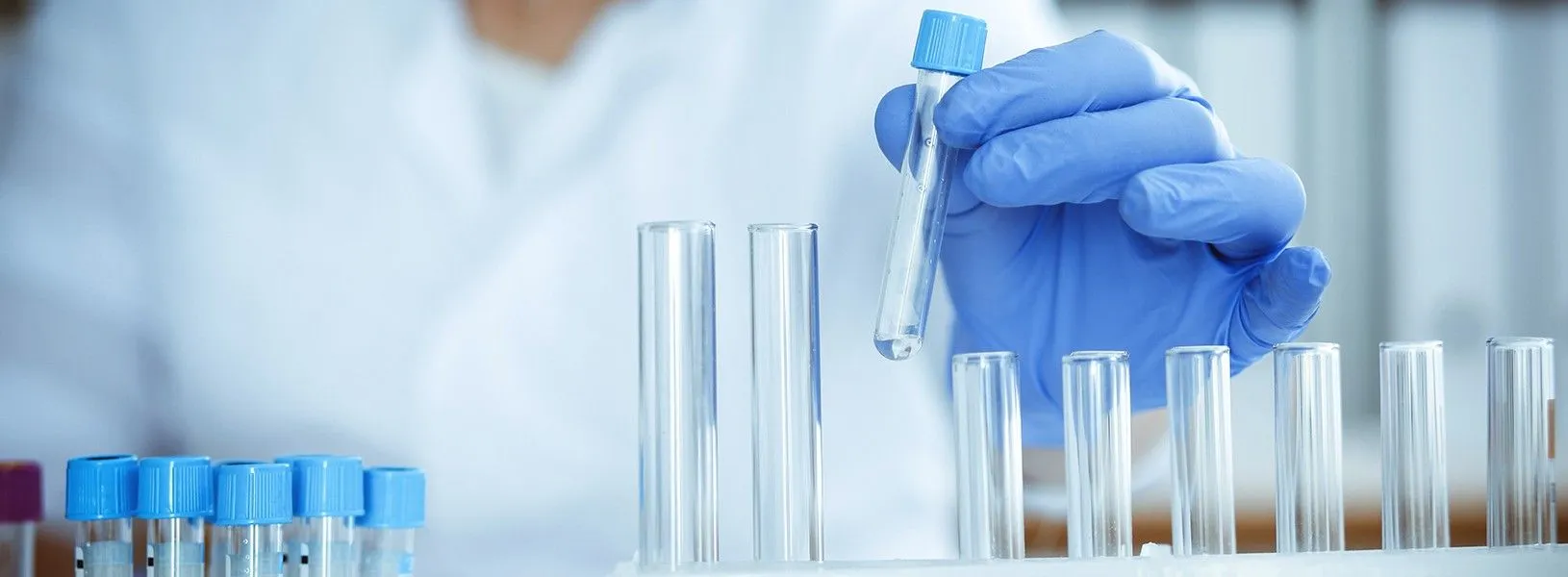 Antigen carcinoembrionar (CEA) - Analize Medicale | MedLife